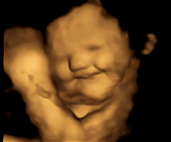 bebeklerin anne karnında iken tat alması - uludağ sözlük galeri