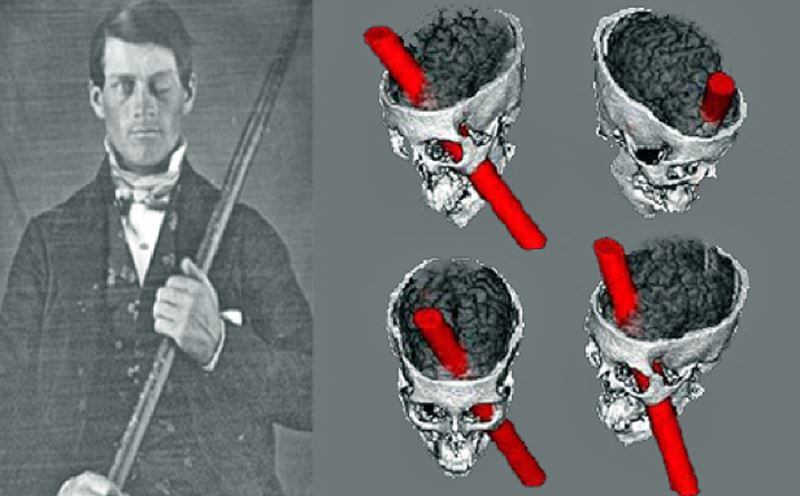 phineas gage - uludağ sözlük